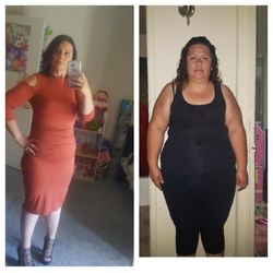 ATIF IQBAL MD - NEW LIFE SURGERY - 54 Photos & 24 Reviews - Fountain ...