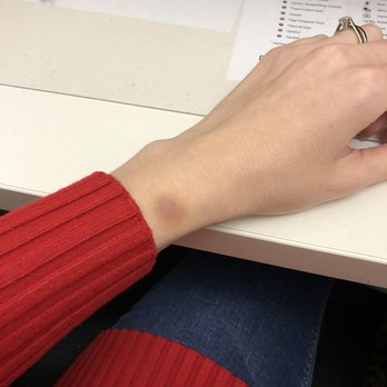 EDGEWATER ACUPUNCTURE - Updated September 2025 - 20 Reviews - 131 Mayo ...