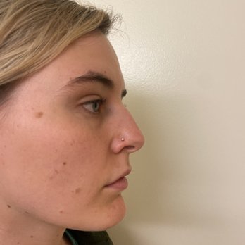 ROD ROHRICH, MD - Updated May 2024 - 14 Photos & 20 Reviews - 9101 N ...