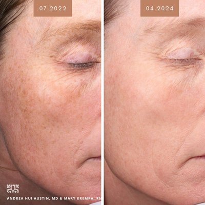 Bay Area Cosmetic Dermatology Updated March 2026 288 Photos 444