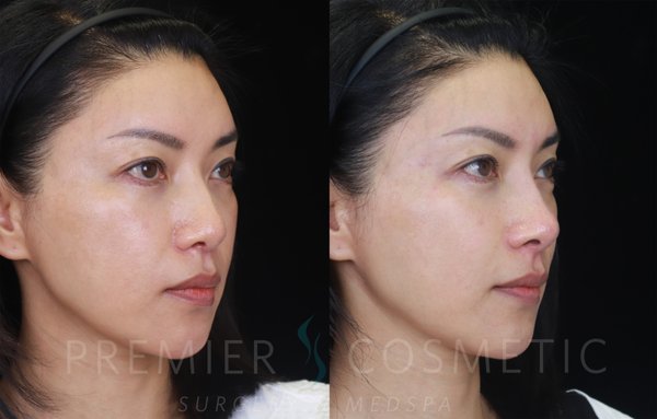 PREMIER COSMETIC SURGERY & MEDSPA - Updated June 2026 - 369 Photos ...
