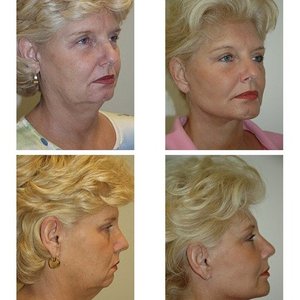 TIM MARTEN, MD - Updated November 2025 - 30 Reviews - 450 Sutter St ...