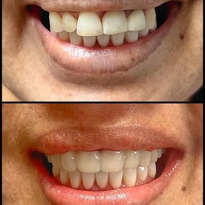 DENNIS PETTIT, DDS - Updated June 2025 - 2225 N Limestone St ...