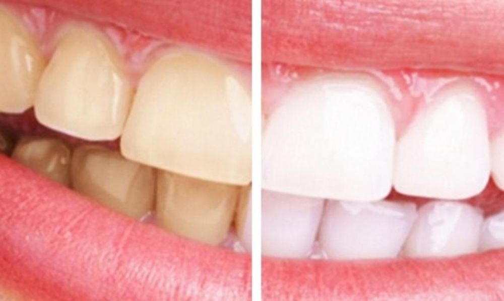 SHANABO DENTAL CLINIC - Updated June 2025 - 27 Photos - 14607 Ramona ...