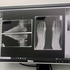 MIAMI FOOT CENTER - Updated July 2025 - 3095 NW 7th St, Miami, Florida ...