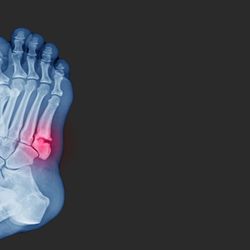 MARK TREZIA, DPM - 20 Photos - Podiatrists - 1500 S Central Ave ...