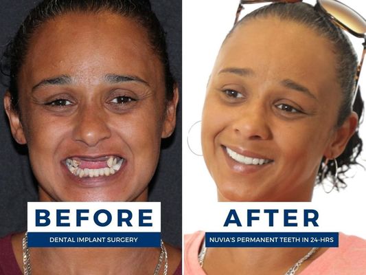 NUVIA DENTAL IMPLANT CENTER - Updated September 2025 - 26 Photos & 14 ...