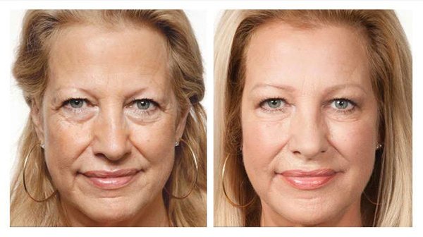BEVERLY HILLS REJUVENATION CENTER - WESTLAKE VILLAGE - Updated June ...