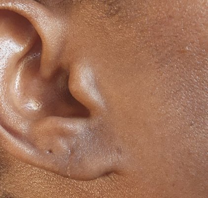 ALAN WEISS, M.D - Updated November 2025 - 17 Reviews - 216 Crain Hwy N ...