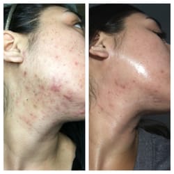 GEORGE HSIEH, MD - ADVANCED DERMATOLOGY & SKIN SURGERY - 14 Photos & 98 ...