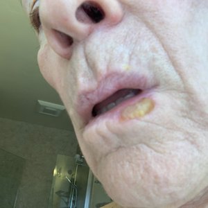 EDWARD ROSS JR, MD - SCRIPPS CLINIC CARMEL VALLEY - Updated April 2025 ...