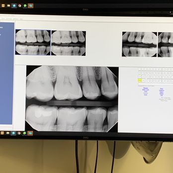 THOMAS BLAKE - Updated September 2025 - 33 Photos & 30 Reviews - 1515 ...