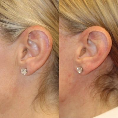 EVAN RANSOM, MD - Updated December 2025 - 126 Photos & 241 Reviews ...