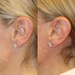 EVAN RANSOM, MD - 124 Photos & 180 Reviews - 450 Sutter St, San ...