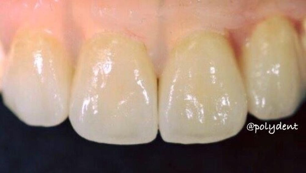 POLY-DENT - 11 Photos - 40 Kodiak Crescent, North York, Ontario, Canada ...