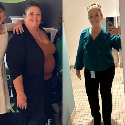 ATIF IQBAL MD - NEW LIFE SURGERY - Updated January 2026 - 56 Photos ...