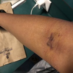 BIOLIFE PLASMA SERVICES - 15 Photos & 14 Reviews - 9312 Arlington Expy ...