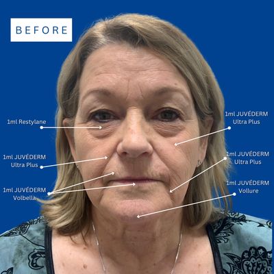 BRETT STOMPRO, MD & CHESTER CHENG, MD - Updated May 2024 - 240 Photos ...