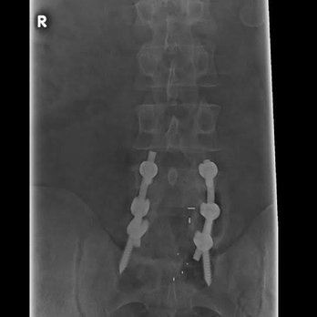 ABAY NEUROSCIENCE - Updated December 2025 - 3223 N Webb Rd, Wichita ...