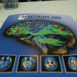 SPECTRUM MRI IMAGING CENTER - 18 Photos & 30 Reviews - Diagnostic ...