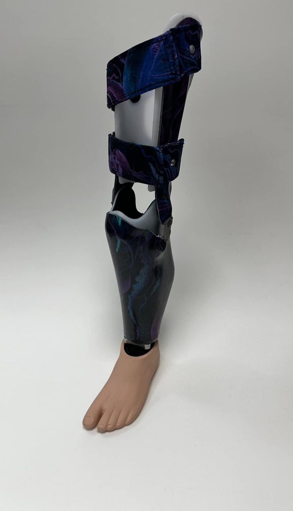 METRO PROSTHETICS - Updated December 2025 - 4320 Fitch Ave, Nottingham ...