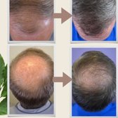 COLLER J OCHSNER, MD - Updated December 2025 - 17 Reviews - 2323 ...