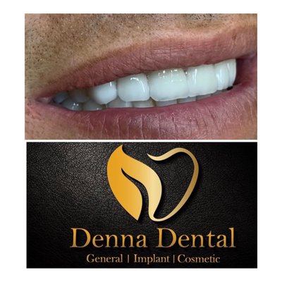 DENNA DENTAL - Updated October 2025 - 18 Photos - 15 Clifton Country Rd ...