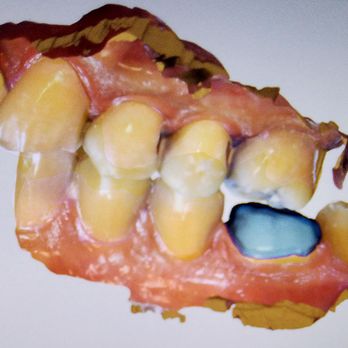 CARSON DENTAL DESIGNS - Updated December 2025 - 13 Photos & 26 Reviews ...