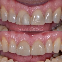 ALISON FISHMAN, DMD - PENINSULA PROSTHODONTIC GROUP - 160 Bovet Rd, San ...