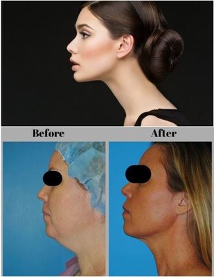 SHARON GIESE, MD - Updated October 2025 - 31 Photos & 13 Reviews - 114 ...