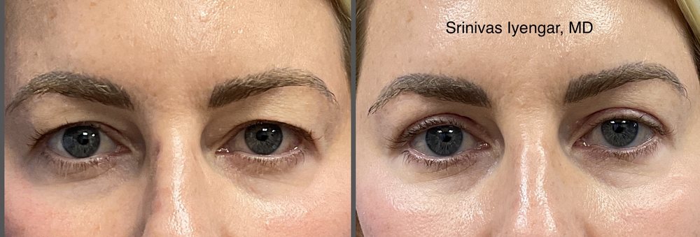 SAN DIEGO EYELID SPECIALISTS - Updated October 2024 - 187 Photos & 118 ...