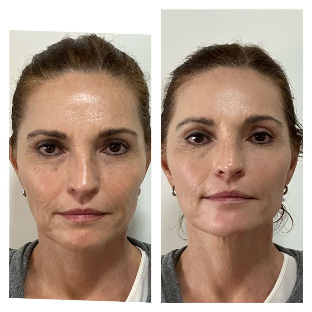 O’LIFE - Updated July 2025 - 91 Photos & 16 Reviews - Schiller 213-4 ...