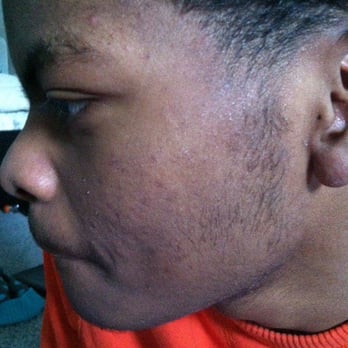 MITCHELL DERMATOLOGY - Updated October 2025 - 17 Photos & 10 Reviews ...