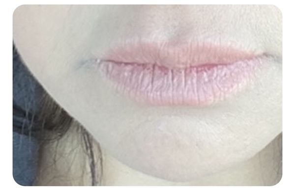 BONNESS COSMETIC SURGERY - Updated October 2025 - 47 Reviews - 20320 W ...