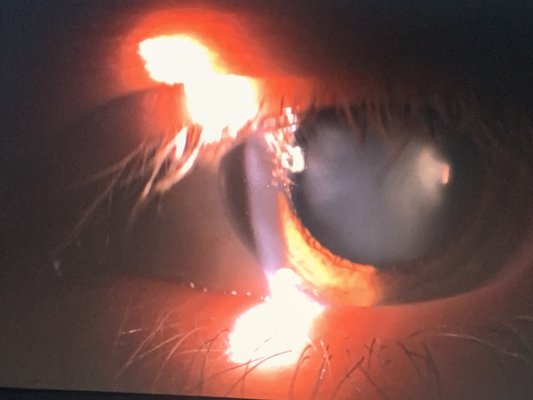 UDAY DEVGAN, MD - Updated October 2025 - 15 Photos & 160 Reviews ...