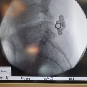 FARDAD MOBIN, MD - 14 Photos & 26 Reviews - Spine Surgeons - 120 S ...