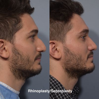 VEGAS FACIAL PLASTICS - MEHDI SINA MD, MBA - Updated December 2025 ...