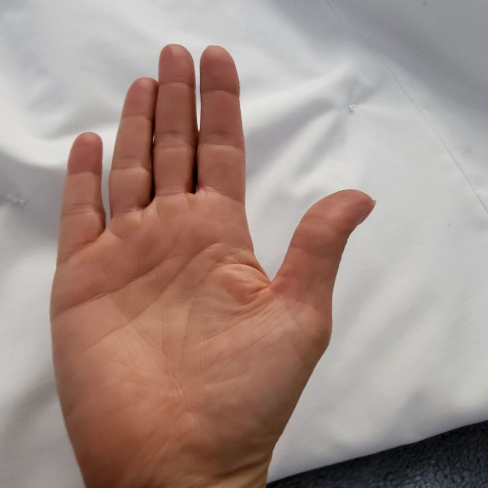 EAST BAY HAND & PLASTIC SURGERY CENTER - Updated July 2025 - 12 Photos ...