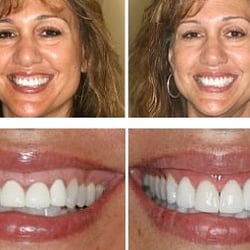 AL A FALLAH, DDS - 29 Photos & 28 Reviews - General Dentistry - 1293 ...