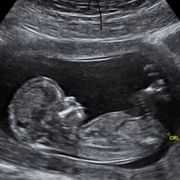 MACE MEDICAL - Updated January 2026 - 13 Reviews - 1124 Mace Ave, Essex ...