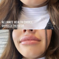 ALLIANCE HEALTH CHOICE - 333 Photos & 389 Reviews - Medical Spas - 1740 ...