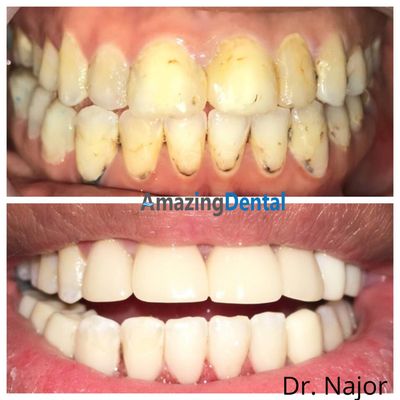 GREAT EXPRESSIONS DENTAL CENTERS - LAHSER RD - Updated October 2025 ...