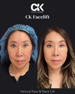 CK PLASTIC SURGERY | 217 Photos & 105 Reviews - 2970 W Olympic Blvd ...