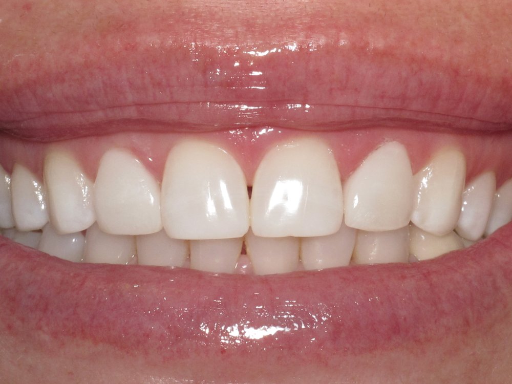 RYAN DAVIS DDS, PC - Updated April 2026 - 700 Belford Ave, Grand ...