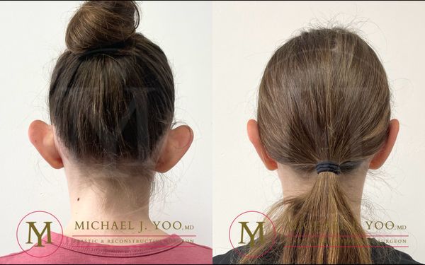 MICHAEL J YOO, MD - Updated May 2026 - 481 Photos & 103 Reviews - 1401 ...