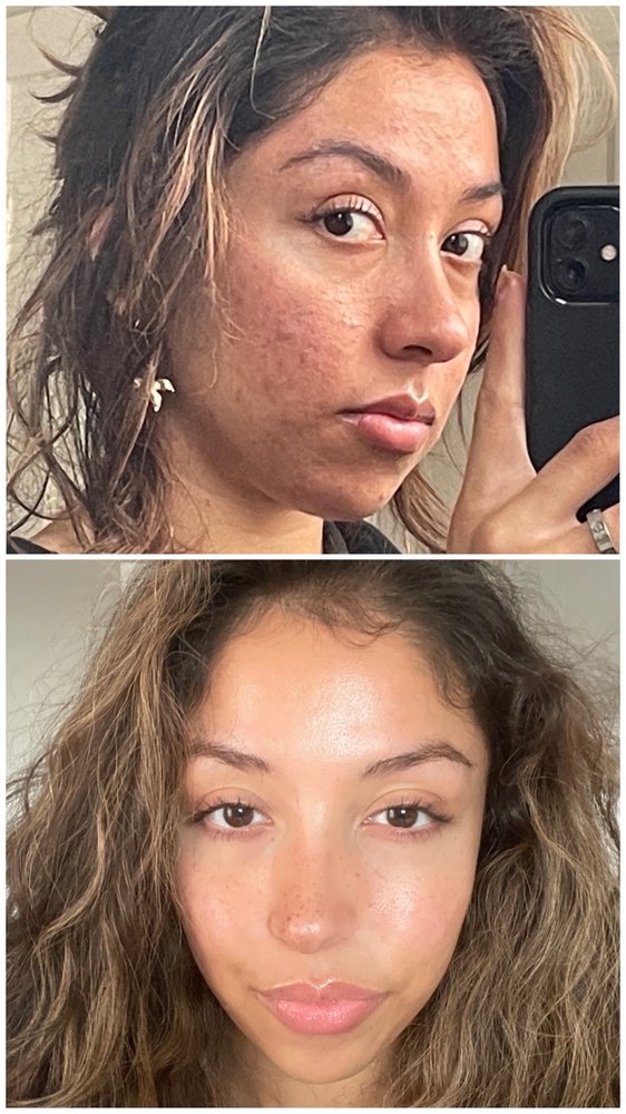 BERKSON MICHAEL H, MD - Updated October 2025 - 18 Reviews - 2800 N ...