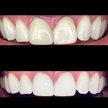 HILLCREST DENTAL GROUP - Updated January 2026 - 14 Photos & 16 Reviews ...