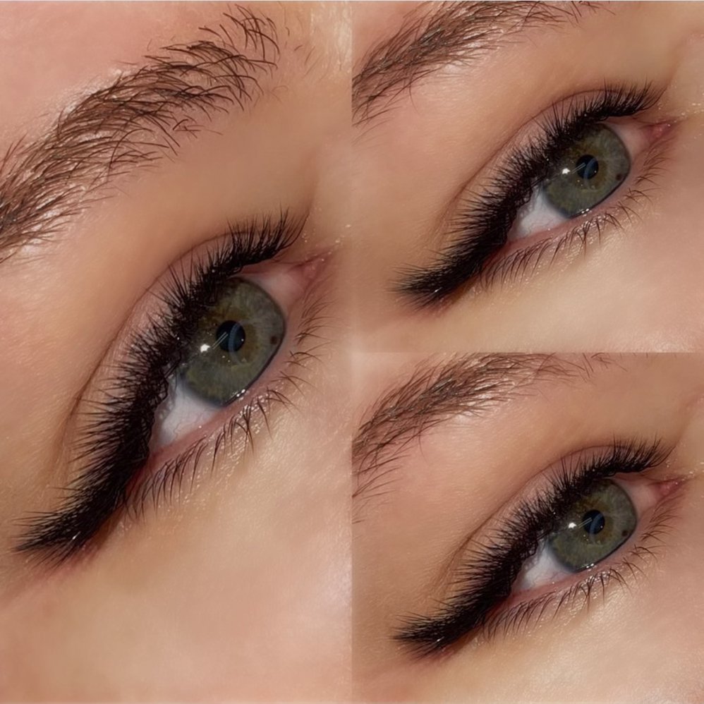 LW ESTHETICS - Updated June 2024 - 175 Photos & 32 Reviews - 4280 S ...