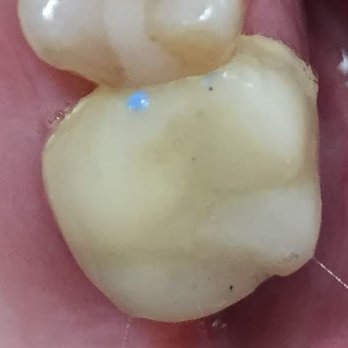 SAMUEL T BANDER, DDS - BANDER DENTAL GROUP OF GRAND RAPIDS - Updated ...