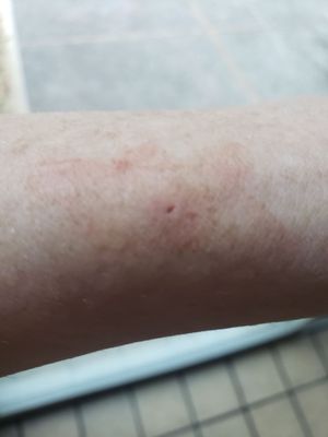 ST. FRANCIS HOSPITAL - Updated January 2026 - 16 Photos & 185 Reviews ...